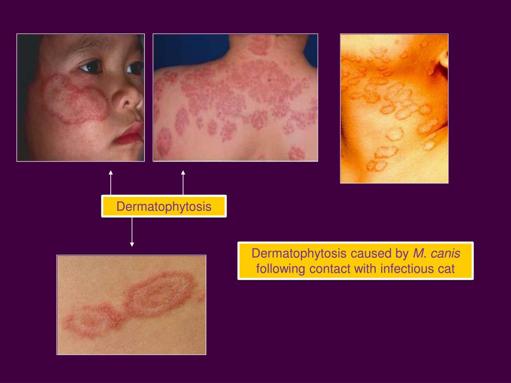 PPT - Medical Mycology PowerPoint Presentation, free download - ID:2067414