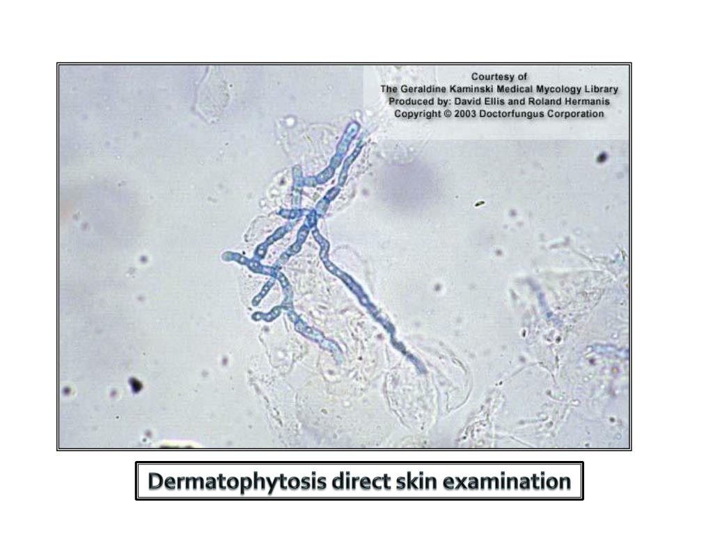 PPT - Medical Mycology PowerPoint Presentation, free download - ID:2067414