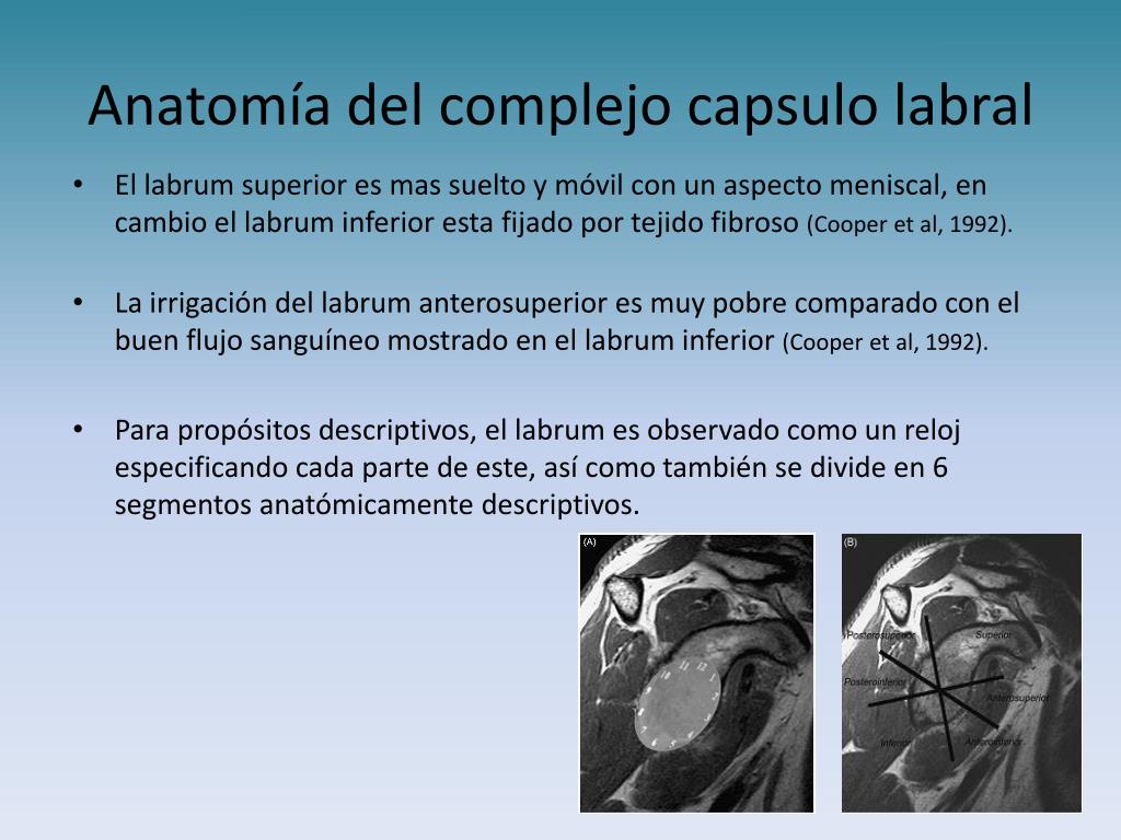 PPT - Lesiones de SLAP “ Anatomía, presentación clínica, diagnostico y ...