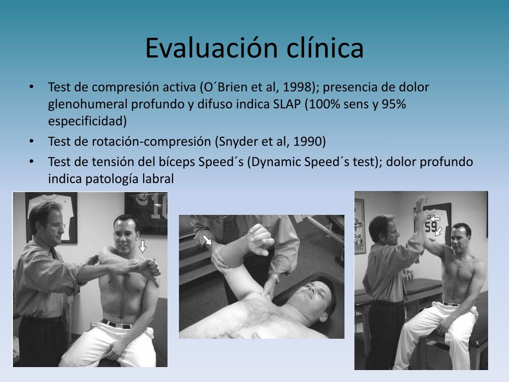 PPT - Lesiones de SLAP “ Anatomía, presentación clínica, diagnostico y ...