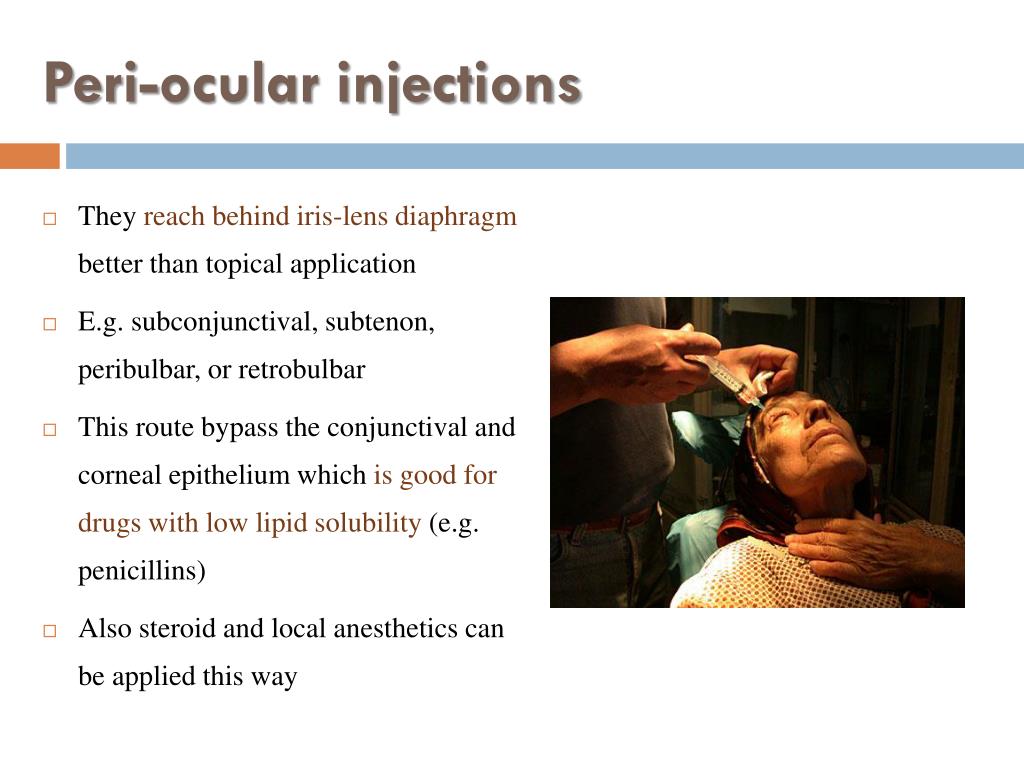 PPT - Ocular pharmacology and toxicology PowerPoint Presentation, free ...