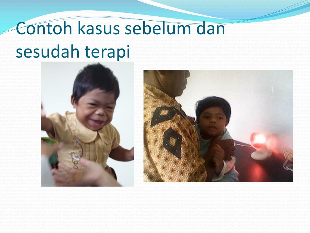 PPT - GAKI (GANGGUAN AKIBAT KEKURANGAN IODIUM PowerPoint Presentation ...