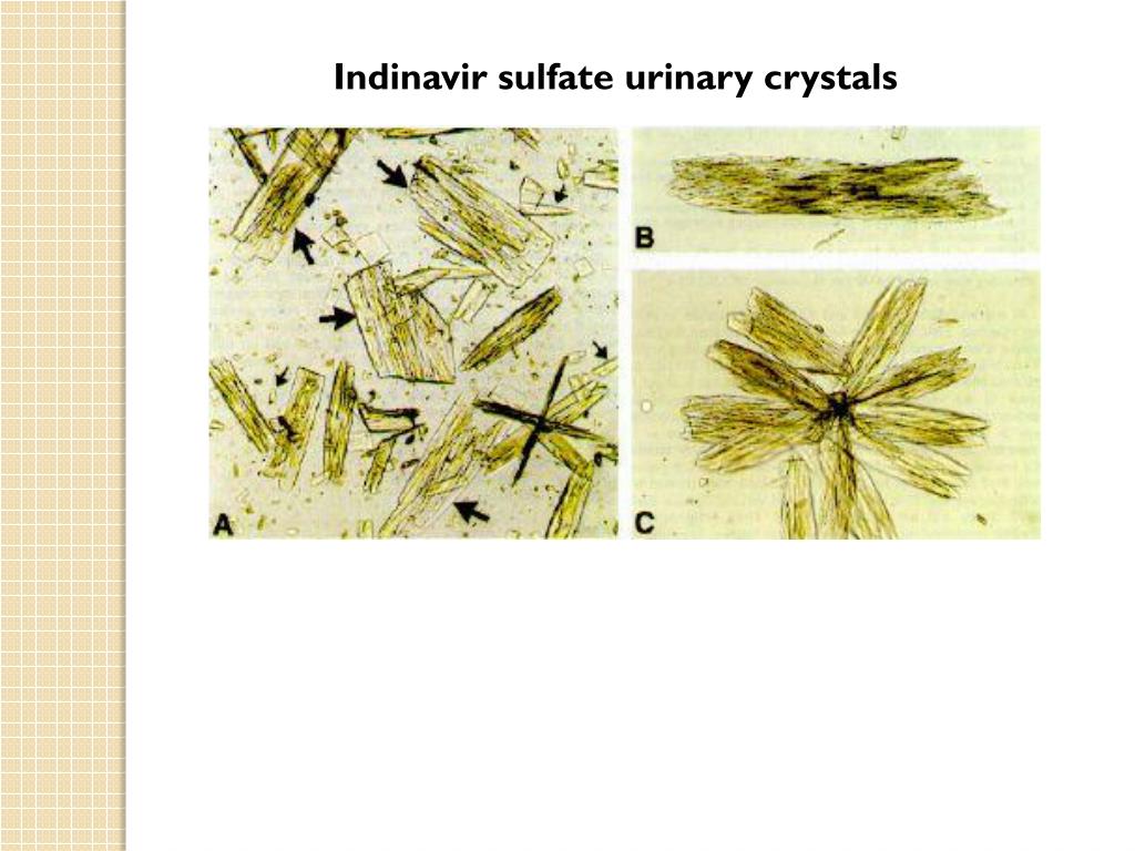 PPT - Drugs in kidney diseases PowerPoint Presentation, free download ...