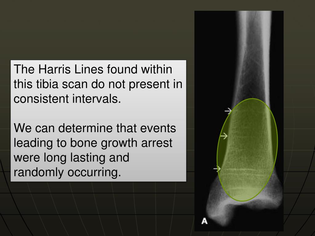 PPT - Hunter-Gatherers vs. Agriculturalists PowerPoint Presentation ...