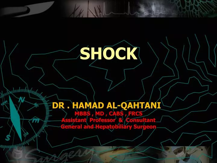 PPT - SHOCK PowerPoint Presentation, free download - ID:2074494