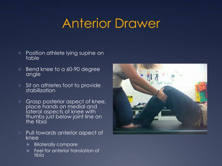 Anterior Drawer Test
