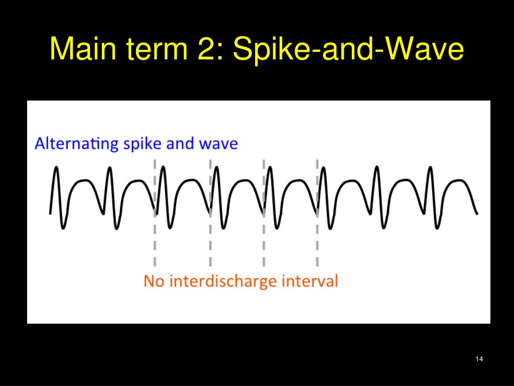 PPT - American Clinical Neurophysiology Society’s Standardized Critical ...