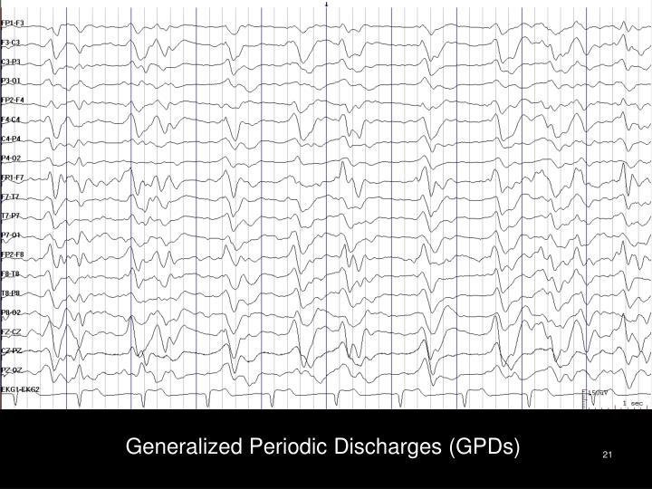 PPT - American Clinical Neurophysiology Society’s Standardized Critical ...