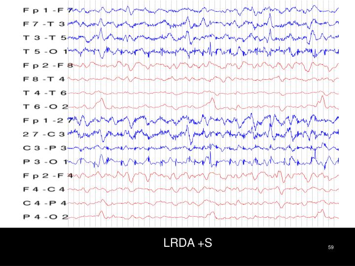 PPT - American Clinical Neurophysiology Society’s Standardized Critical ...