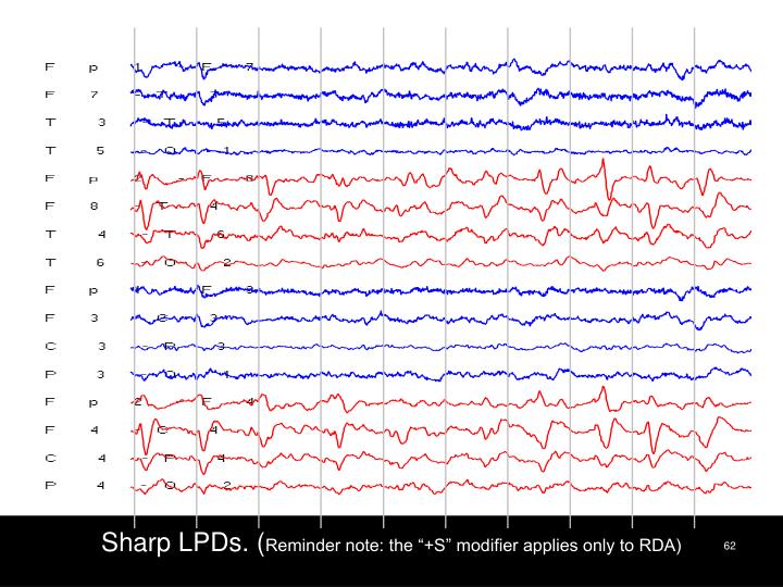 PPT - American Clinical Neurophysiology Society’s Standardized Critical ...
