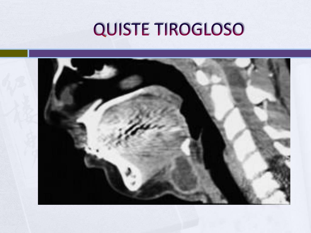 PPT - ENFOQUE DIAGNÓSTICO DE LAS MASAS DE CUELLO PowerPoint ...