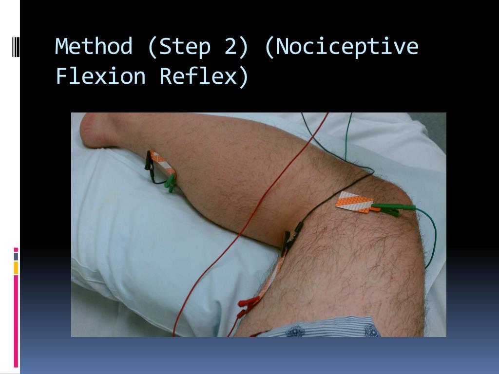 PPT - Identification of Sural Nociceptive Flexion Reflex Ratio in Adult ...