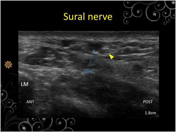 PPT - Ankle block PowerPoint Presentation - ID:2075464