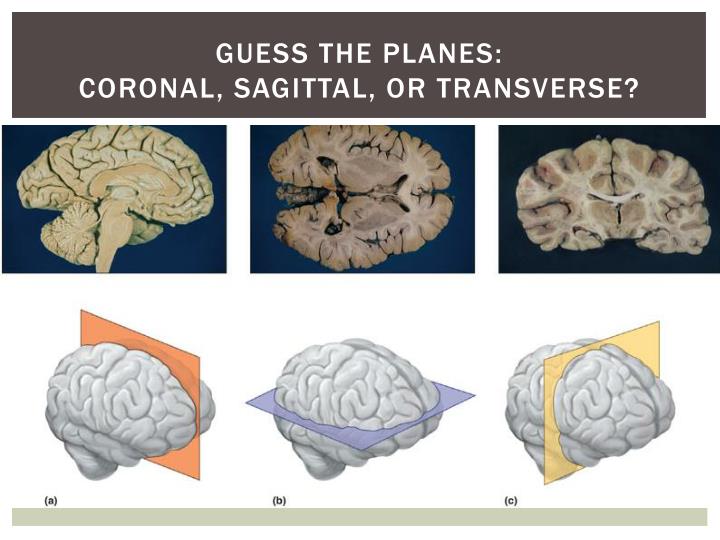 PPT - Anatomical Terminology PowerPoint Presentation - ID:2075780