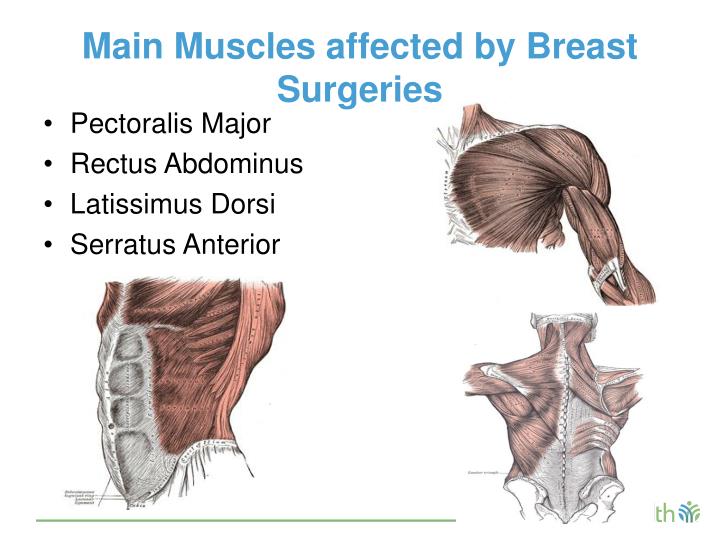PPT - Breast Cancer Rehabilitation PowerPoint Presentation - ID:2077045
