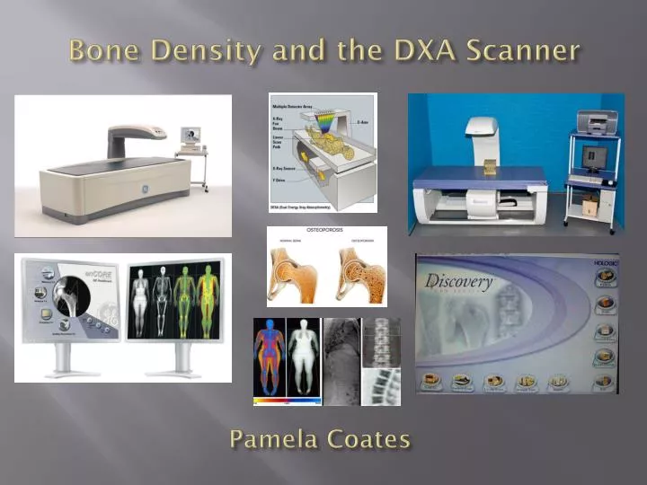 PPT - Bone Density and the DXA Scanner PowerPoint Presentation, free ...