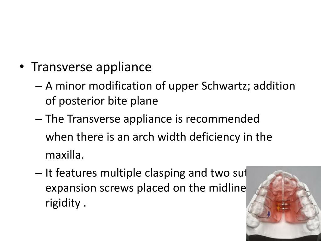 PPT - Hawley’s retainer & other URA PowerPoint Presentation, free ...