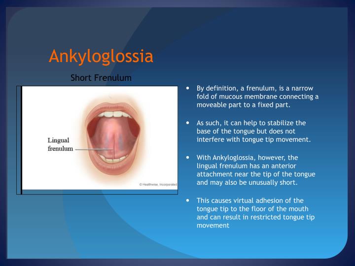 PPT - ANKYLOGLOSSIA PowerPoint Presentation - ID:2078965