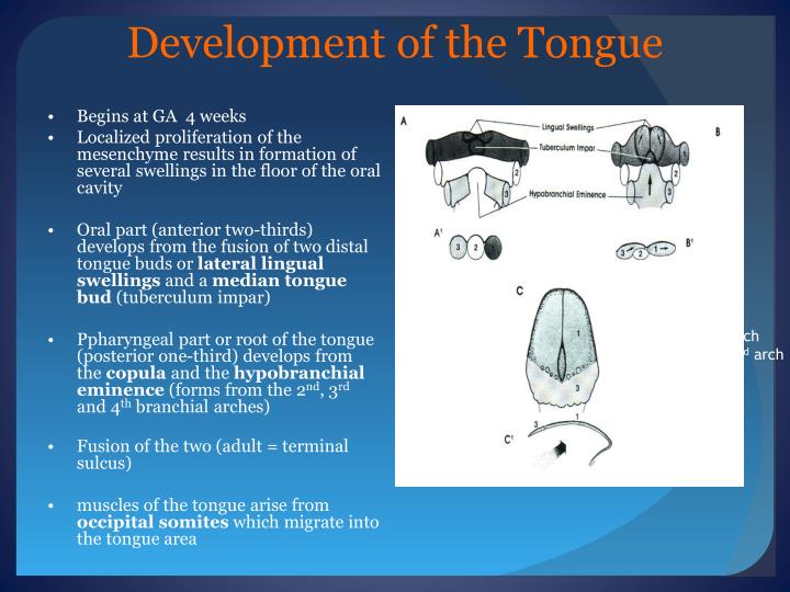 PPT - ANKYLOGLOSSIA PowerPoint Presentation - ID:2078965