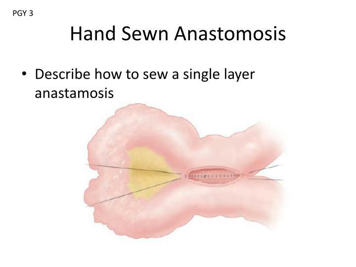 PPT - Vascular and Intestinal Anastomotic Workshop PowerPoint ...