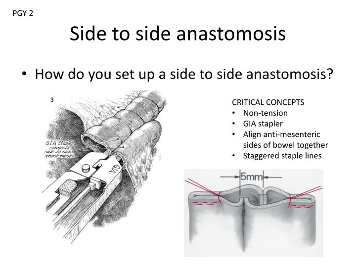 PPT - Vascular and Intestinal Anastomotic Workshop PowerPoint ...