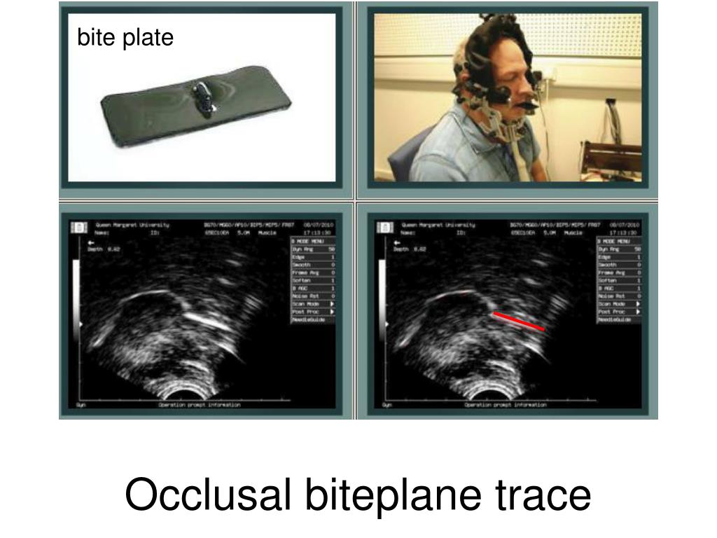 PPT - LOT summer school Ultrasound, phonetics, phonology: Articulation ...