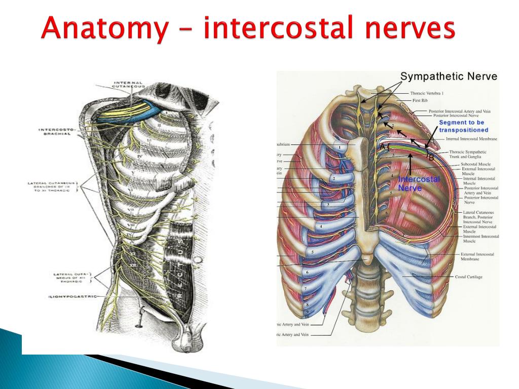 PPT - Novel Treatments of Rib Fractures: Hype or Future? PowerPoint ...