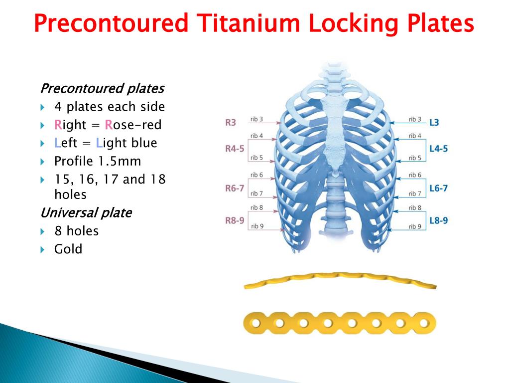 PPT - Novel Treatments of Rib Fractures: Hype or Future? PowerPoint ...