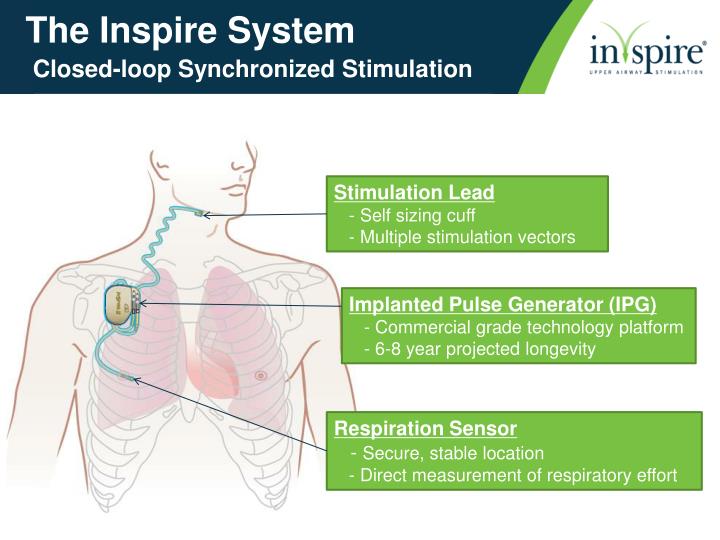 PPT - “A Solution for Obstructive Sleep Apnea: Closed Loop ...