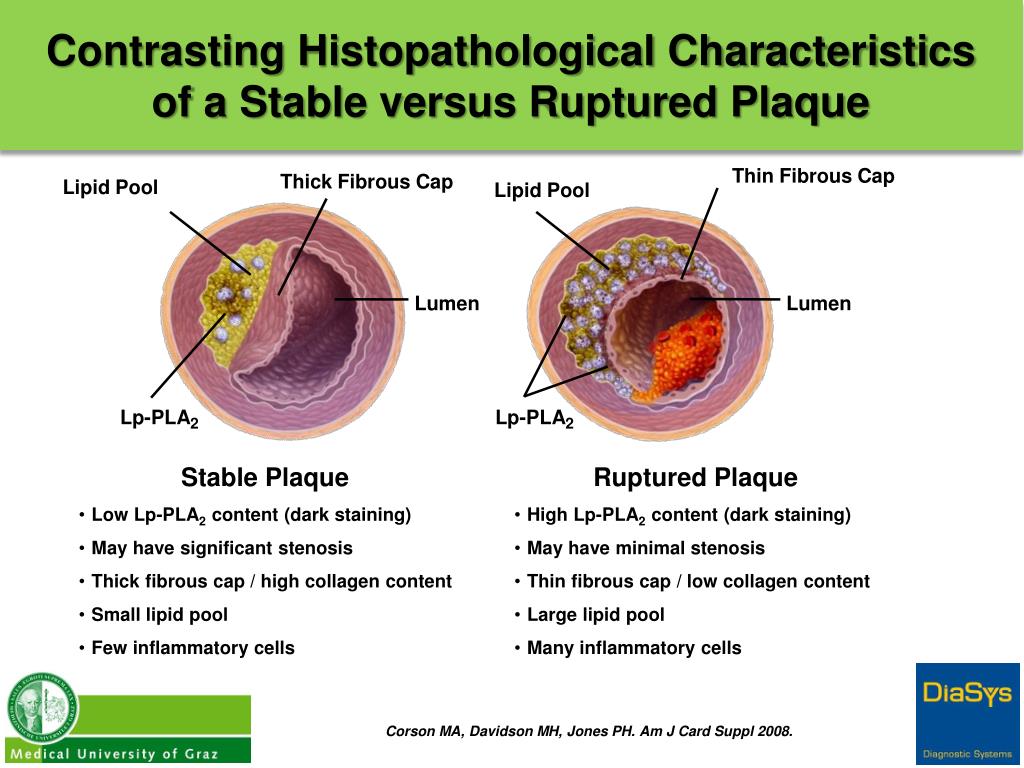 PPT - Lp-PLA 2 Lipoprotein-associated phospholipase A 2 PowerPoint ...