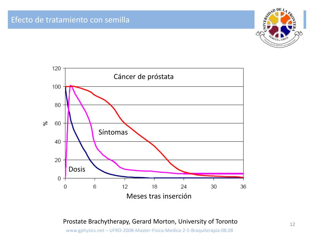 PPT - Métodos y Terapias 2.5 Braquiterapia PowerPoint Presentation ...