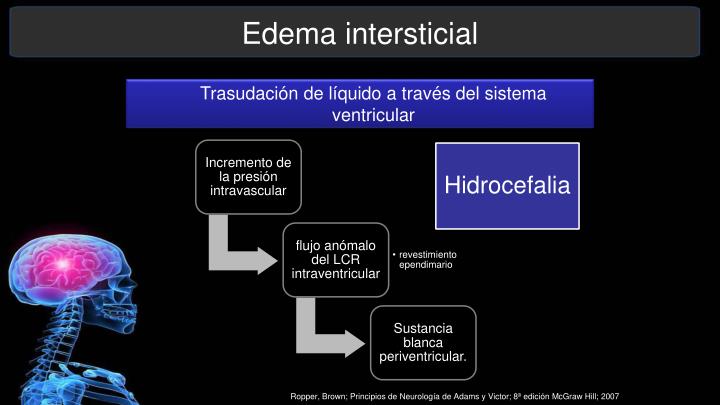 PPT - Edema cerebral Gutiérrez Rosales Aldo 8°C Neurología PowerPoint ...