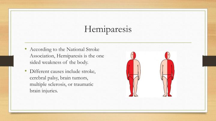 PPT - Sit to Stand Training in Stroke Patients PowerPoint Presentation ...