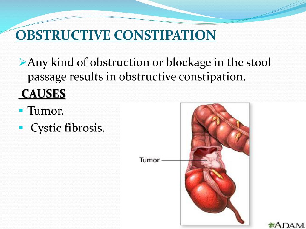 PPT - GASTRO – INTESTINAL TRACT DISEASES PowerPoint Presentation, free ...