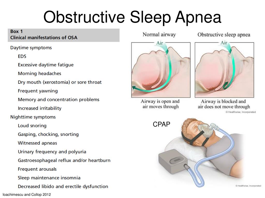 PPT - The Neurobiology of Sleep and Sleep Disorders PowerPoint ...