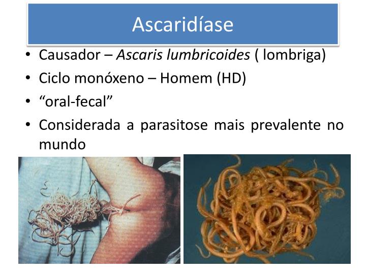 PPT - Verminoses PowerPoint Presentation - ID:2095947