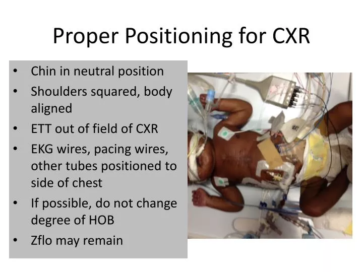 PPT - Proper Positioning for CXR PowerPoint Presentation, free download ...