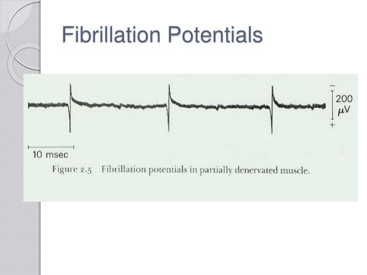PPT - Electromyography (EMG) PowerPoint Presentation - ID:2098137
