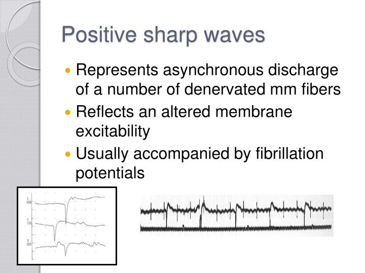 PPT - Electromyography (EMG) PowerPoint Presentation - ID:2098137