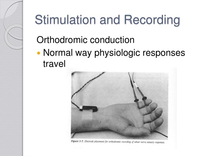 PPT - Electromyography (EMG) PowerPoint Presentation - ID:2098137