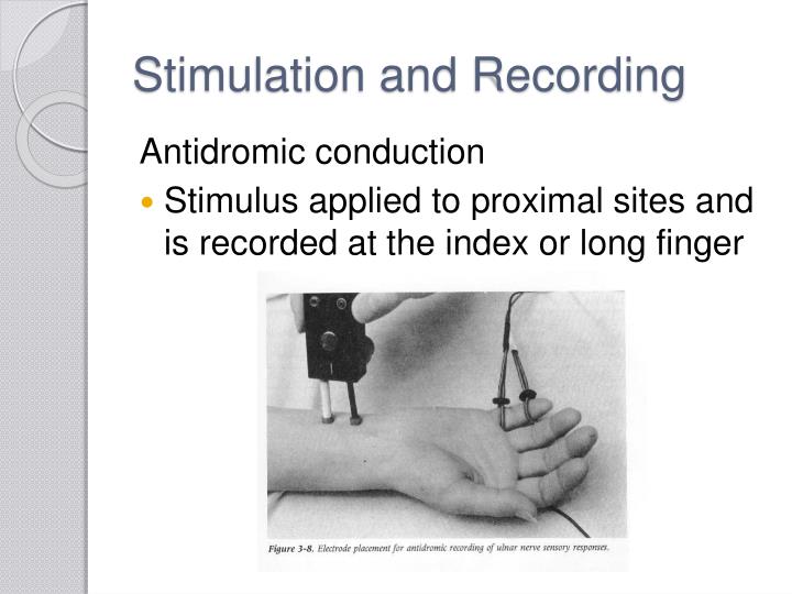 PPT - Electromyography (EMG) PowerPoint Presentation - ID:2098137