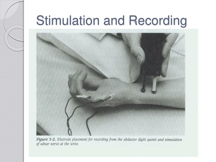 PPT - Electromyography (EMG) PowerPoint Presentation - ID:2098137