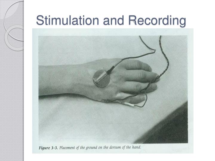 PPT - Electromyography (EMG) PowerPoint Presentation - ID:2098137
