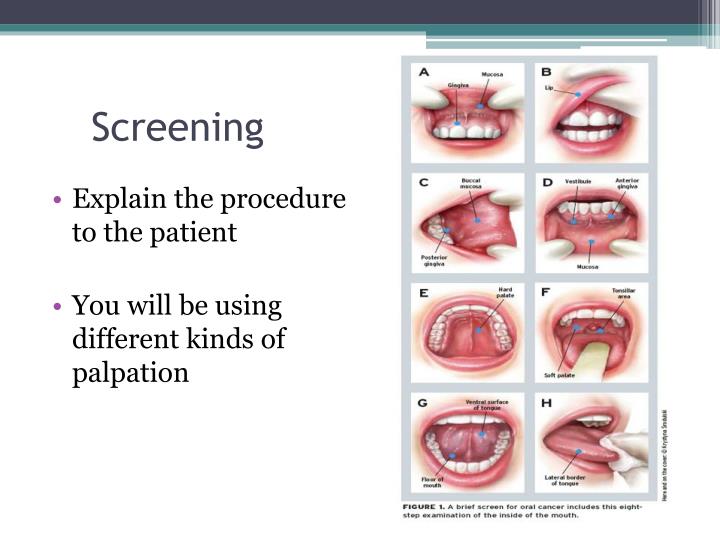 PPT - The Oral-Systemic Link PowerPoint Presentation - ID:2098245