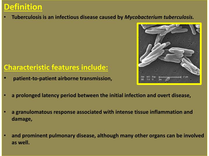 PPT - Tuberculosis PowerPoint Presentation - ID:2098271
