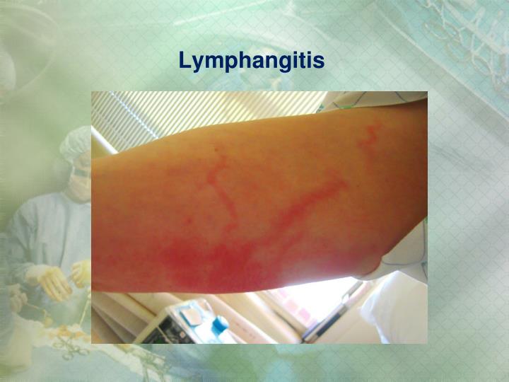 PPT - Surgical Infection PowerPoint Presentation - ID:2098299