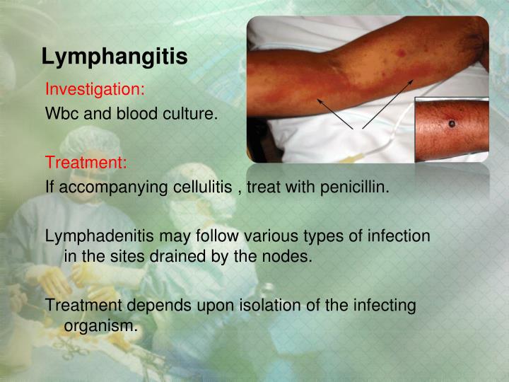 PPT - Surgical Infection PowerPoint Presentation - ID:2098299