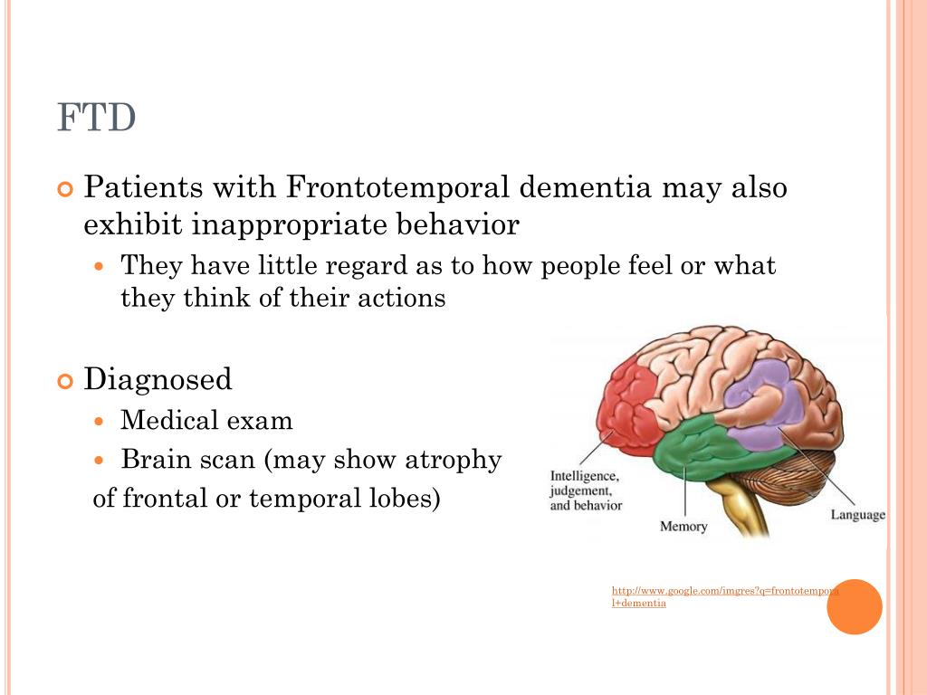 PPT - Non-Alzheimer’s Dementia PowerPoint Presentation, free download ...