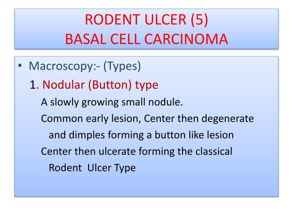 Ppt Skin Tumours Powerpoint Presentation Free Download Id 2099505