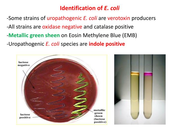 PPT - Urinary tract infection ( UTI ) PowerPoint Presentation - ID:2101291